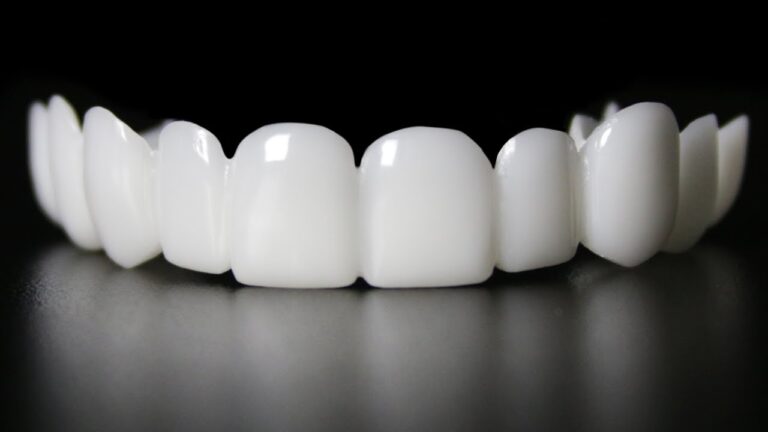 Clip On Veneers - Selfdentist